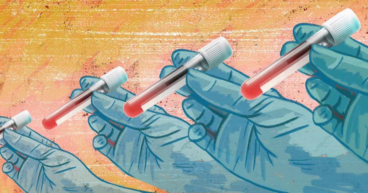 Chronic Hives Diagnosis: Tests & Lab Work Explained